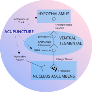 Acupuncture Treatment - Rivernorth Acupuncture | Los Angeles County, CA